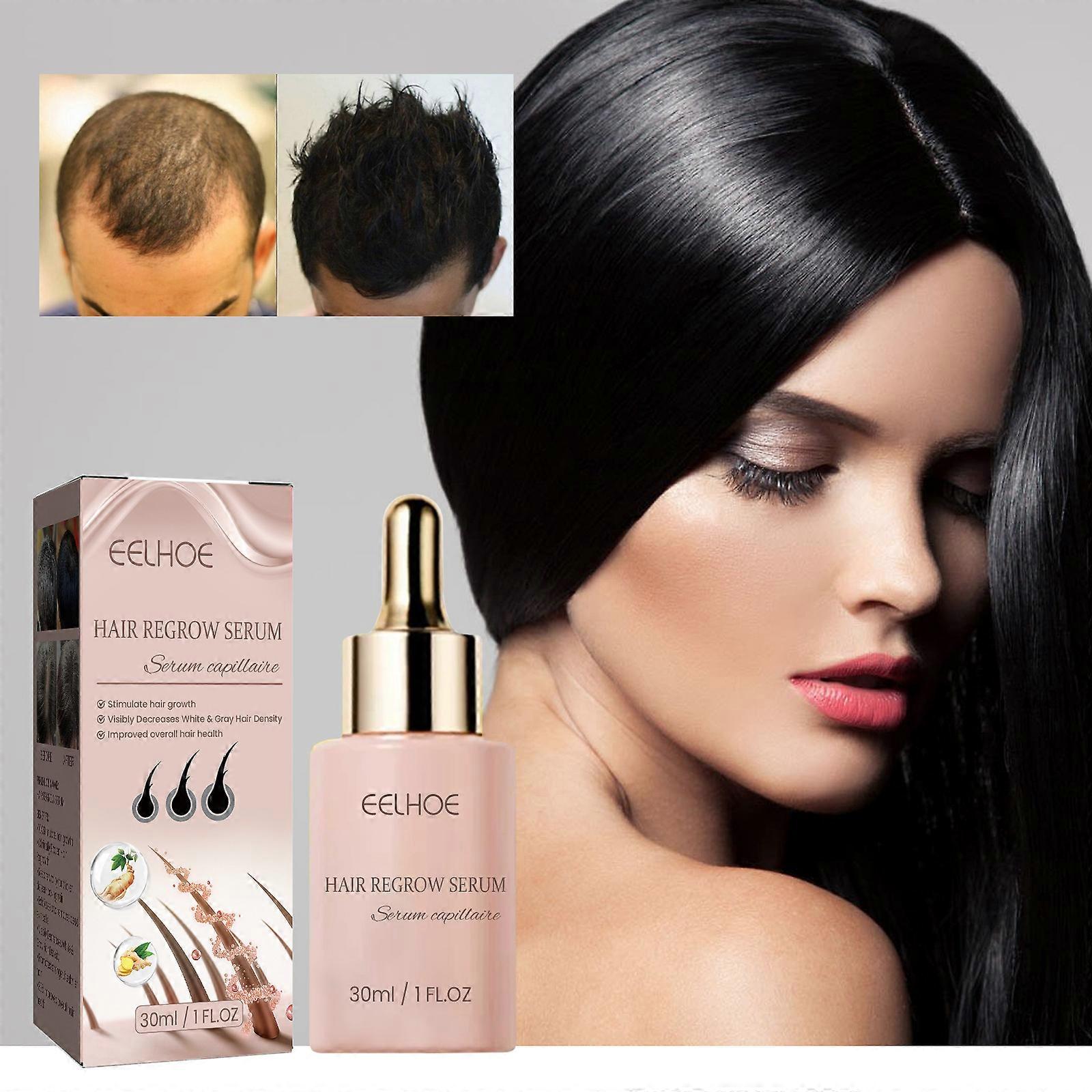 Hair Growth Serum, Hair Regrow Serum, Advanced Formula for Fuller ...