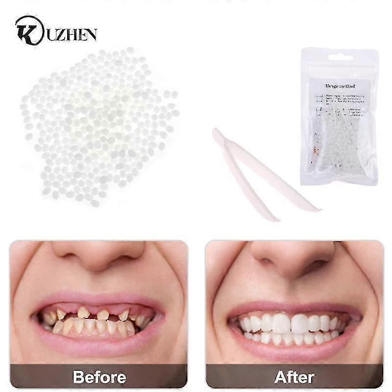 20g Denture Adhesives Cement Temporary Tooth Filling Cavity Repair Tool ...
