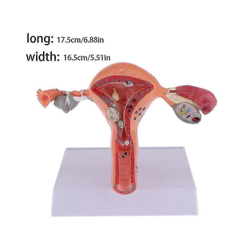Female Uterus Structure Biological Models Educational Experiment | Fruugo UK