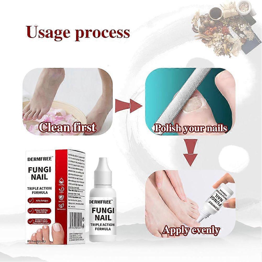 15ml Fungi Nail Treatment Liquid Fast-Acting Nail Repair Strengthening ...