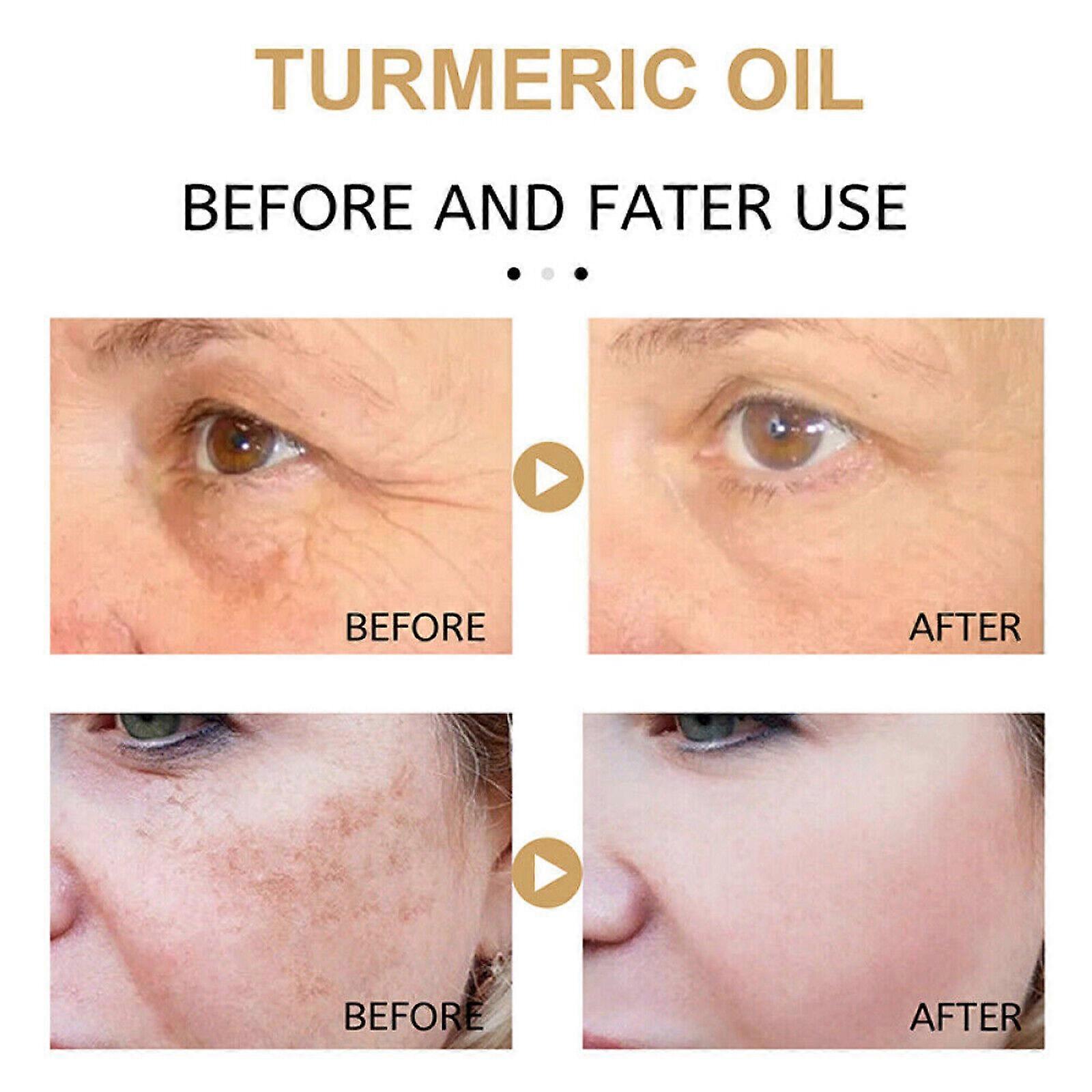 Turmeric Cream Dark Spot Corrector Skin Melasma Remove Wrinkles Serum ...