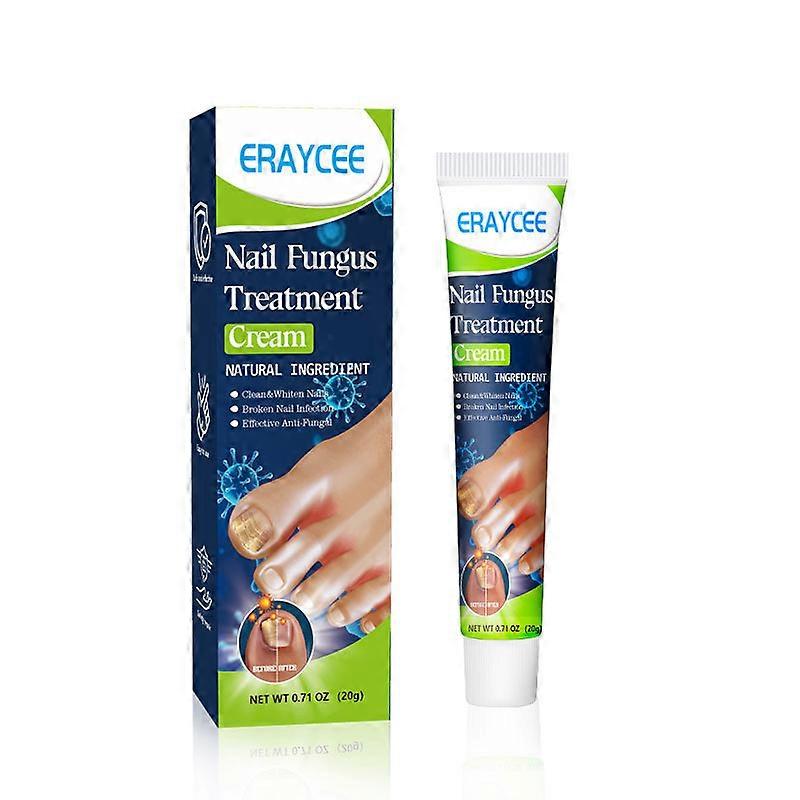 Nail Fungus Treatment Cream, 20g Toenail Fungus Treatment Cream, Strong ...