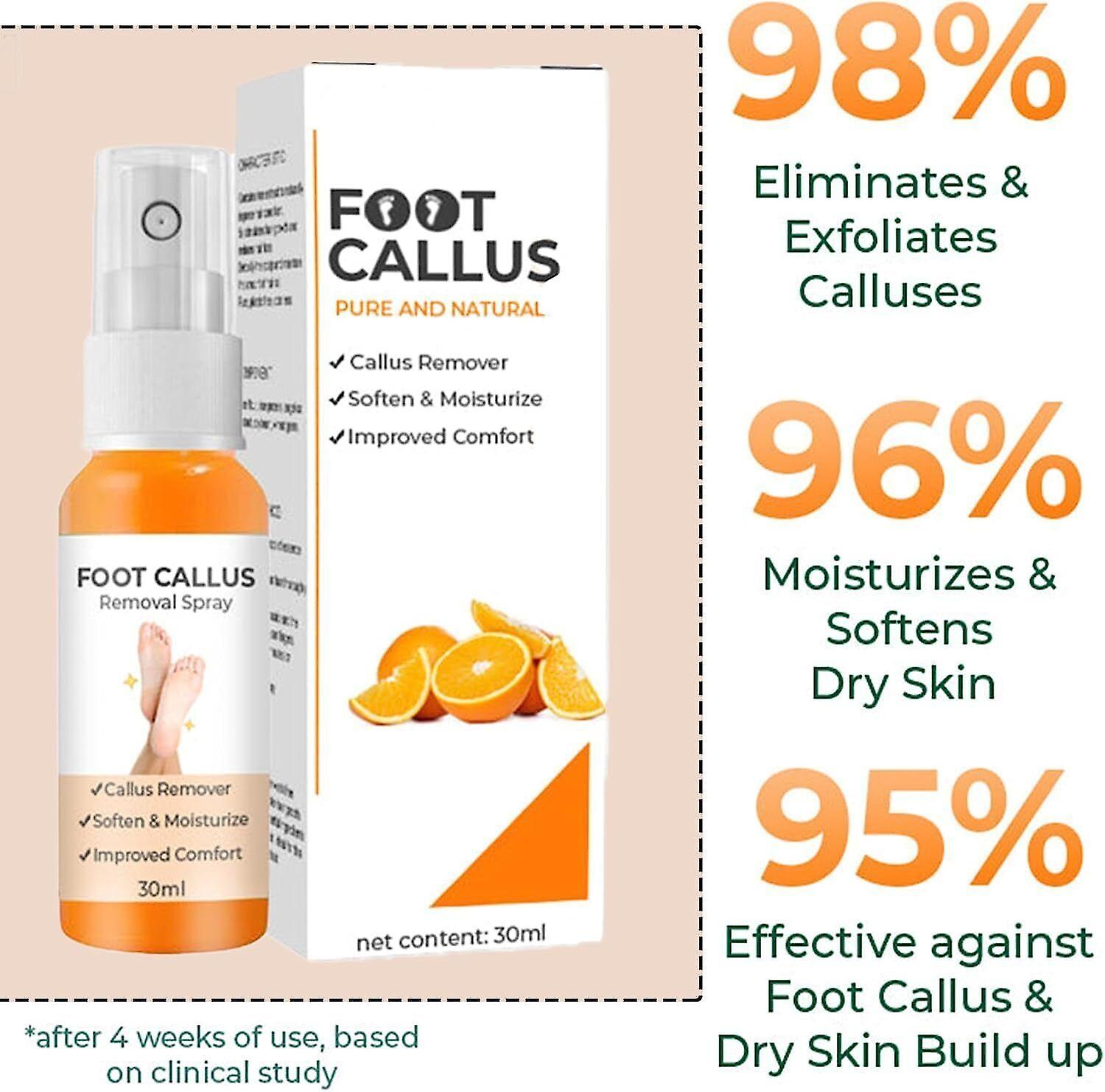 Foot Callus Removal Spray, Foot Heel Callus Remover Spray, Foot Peel ...