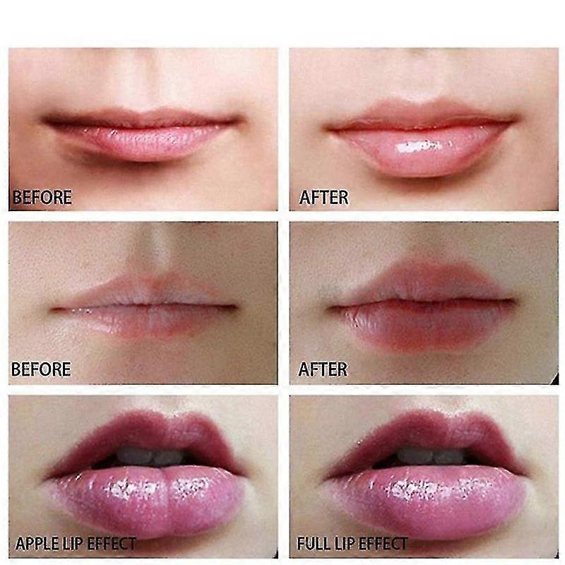 Automatic Lip Plumper Enhancer Device Electric Fuller Lip Silicone ...