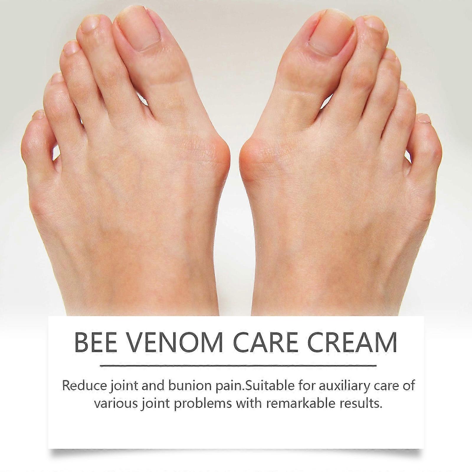 Bee Venom Bunion Care Cream, Support Hallux Valgus Hammer Toe Pain ...