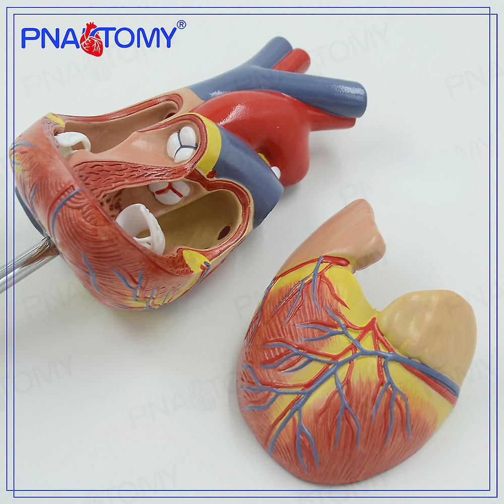 Kx-a401 Heart Model 4-stage Vascular Artery Pathological Stage Cardiac ...