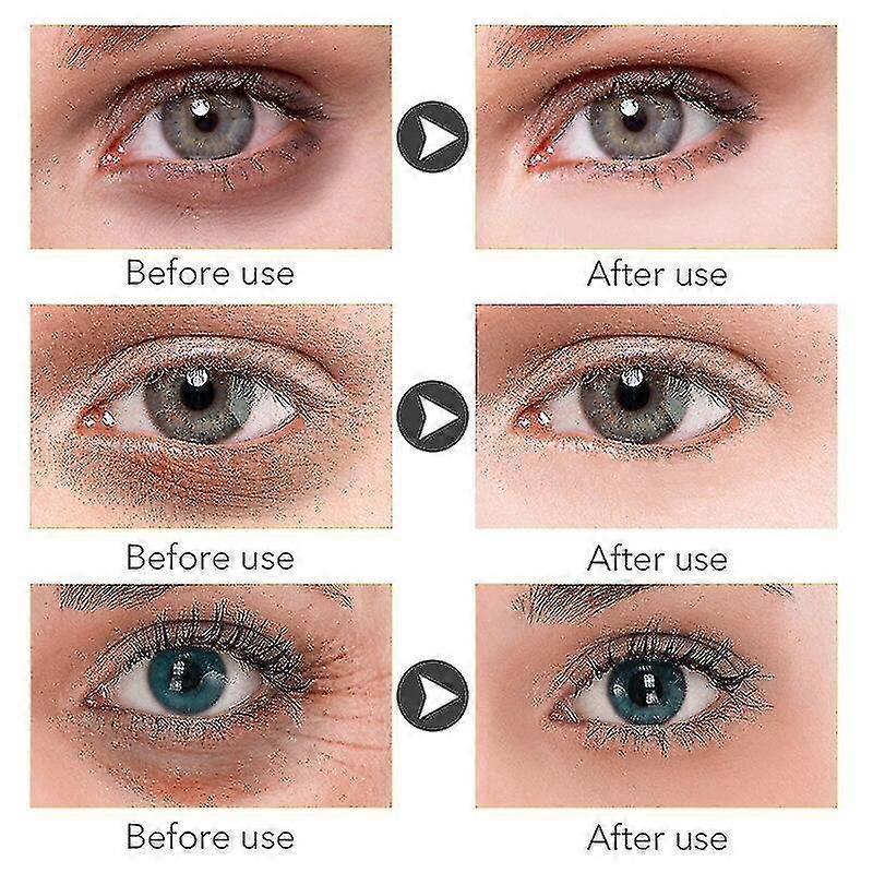 Instant Removal Eye Bags Cream Retinol Cream Anti Puffiness Gel Dark ...