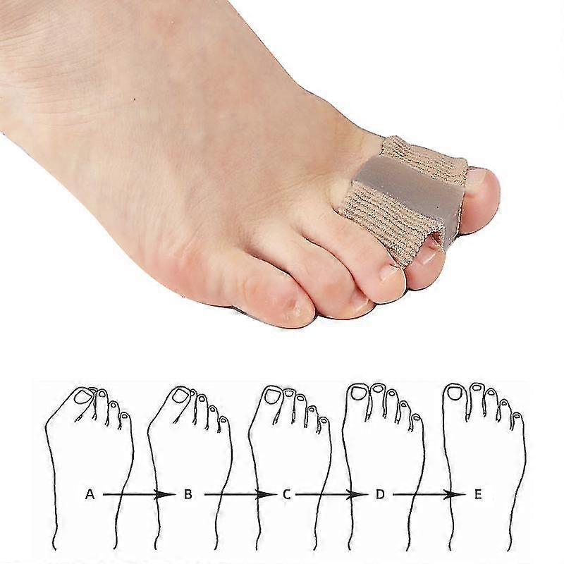 Toe splitter, hallux valgus, big foot bone overlapping toe separator ...