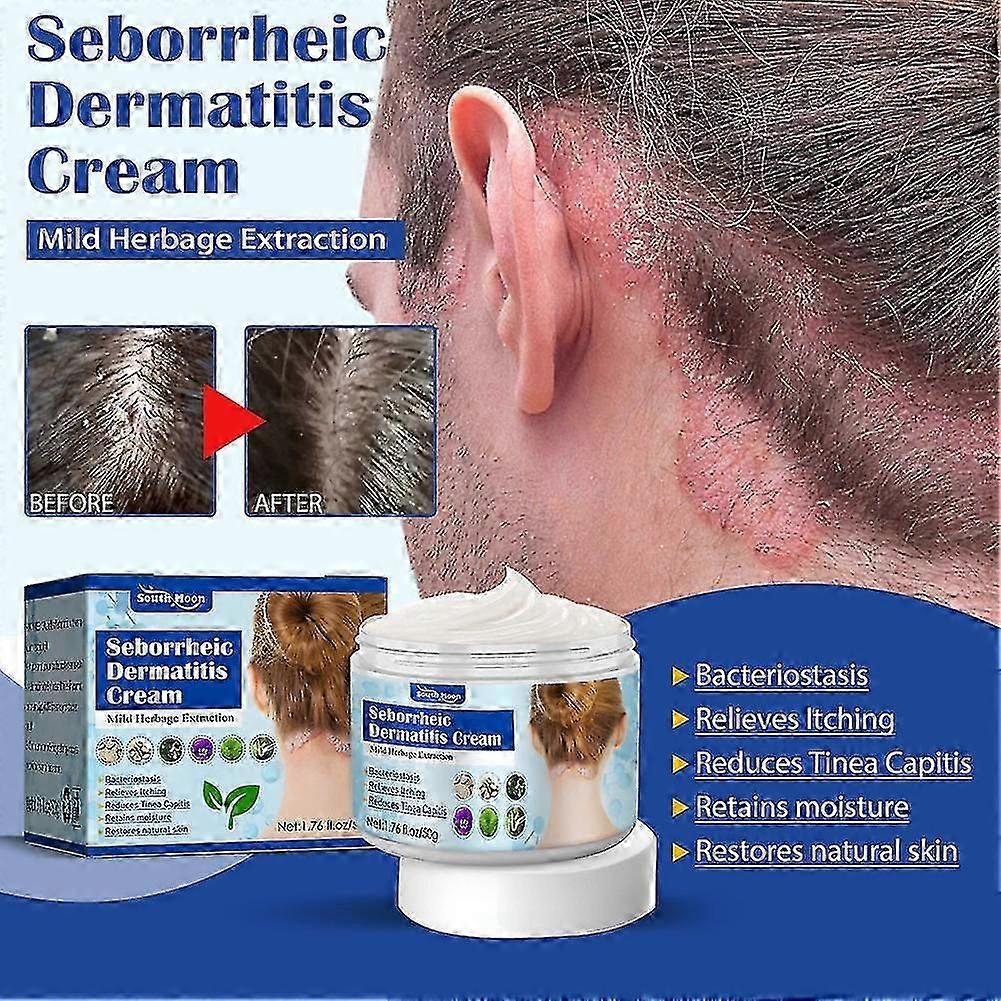 Seborrheic Skin Cream Head Acne Tinea Pruritus Anti-itch Psoriasis ...
