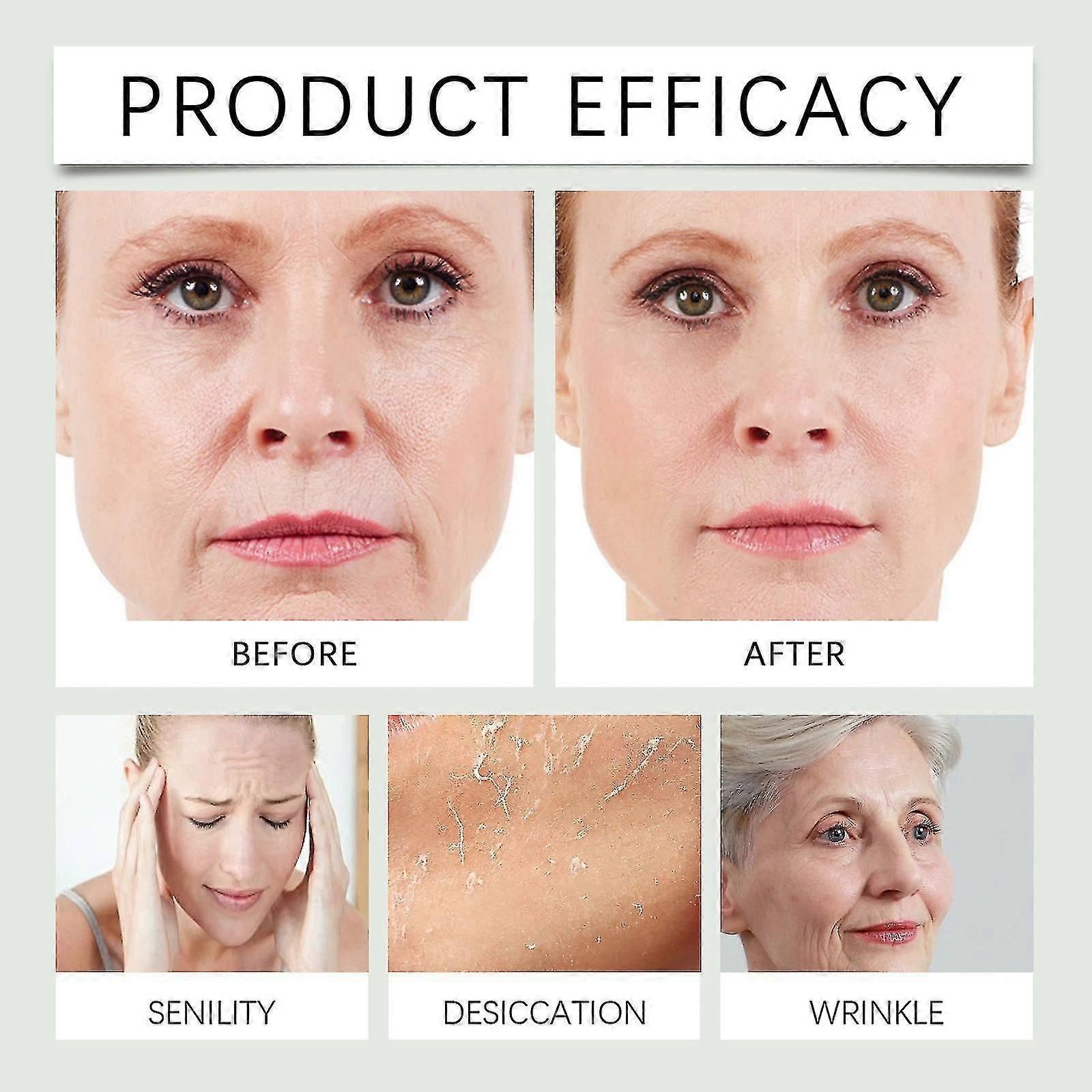 Moss Ointment Moisturizer, Moss Cream Against Wrinkles, Instant Effect ...