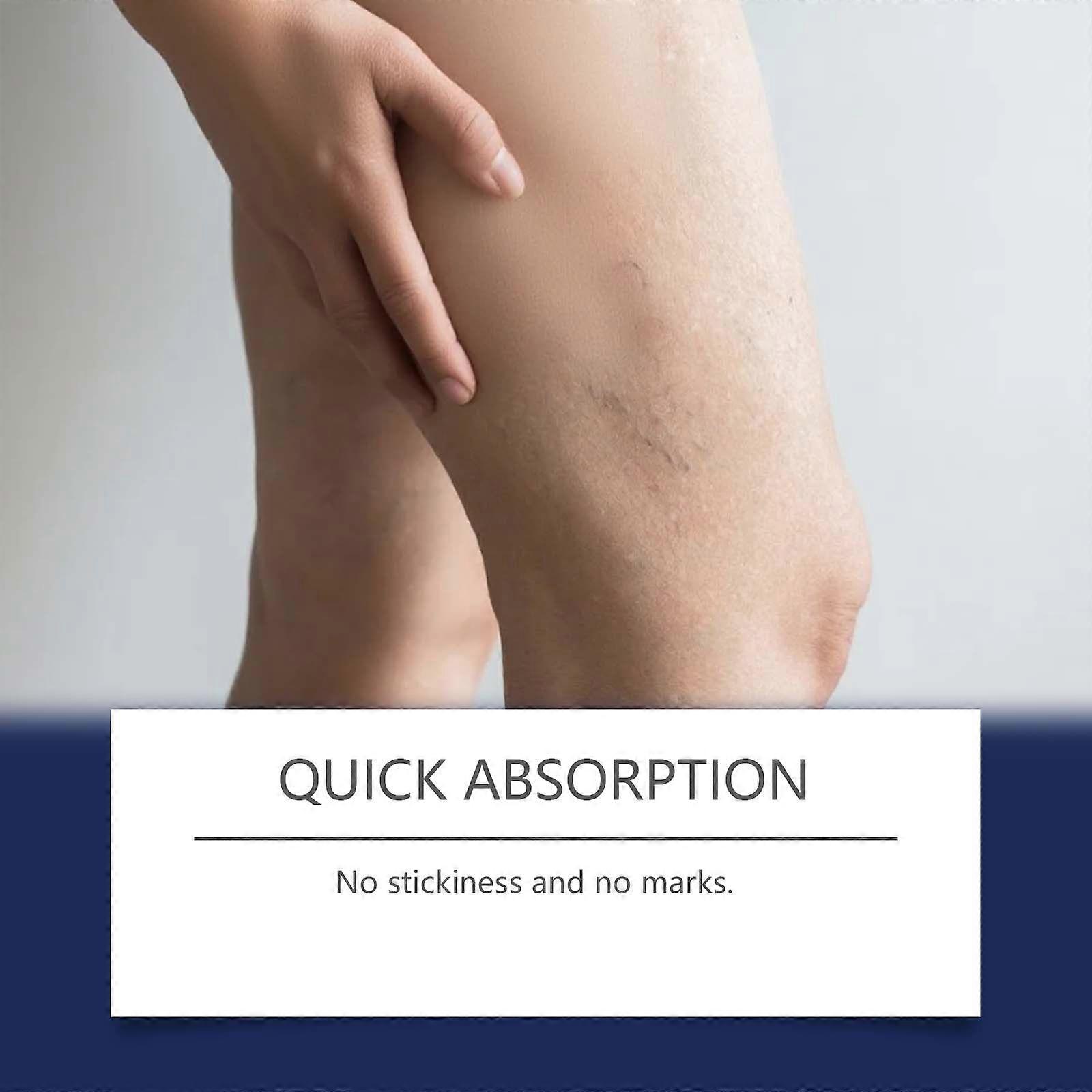 Anti-Varicose Herbal Spray, Anti-Varicose Soothing Spray, Soothing Leg ...