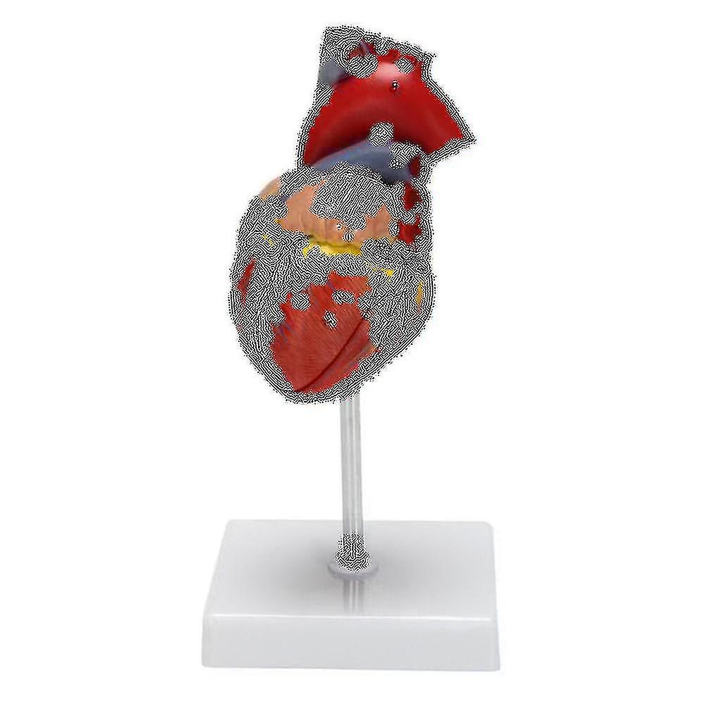 1: 1 Human Heart Model, Anatomically Accurate Heart Model Life Size ...