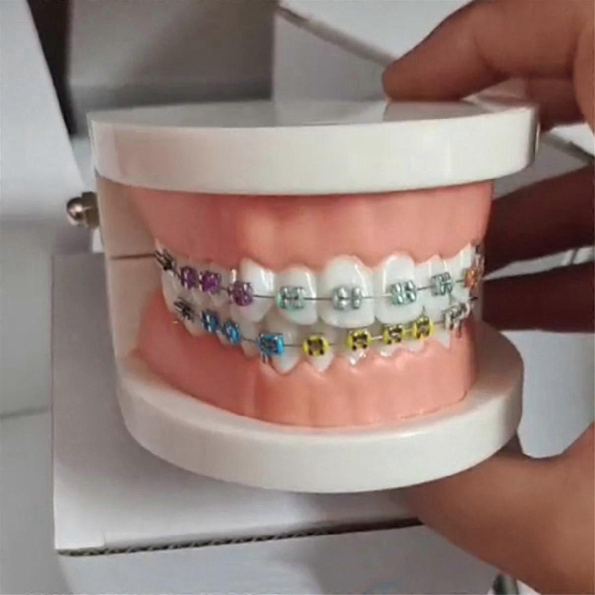 Dental Orthodontic Treatment Teeth Model with Bracket Arch Wire Buccal ...