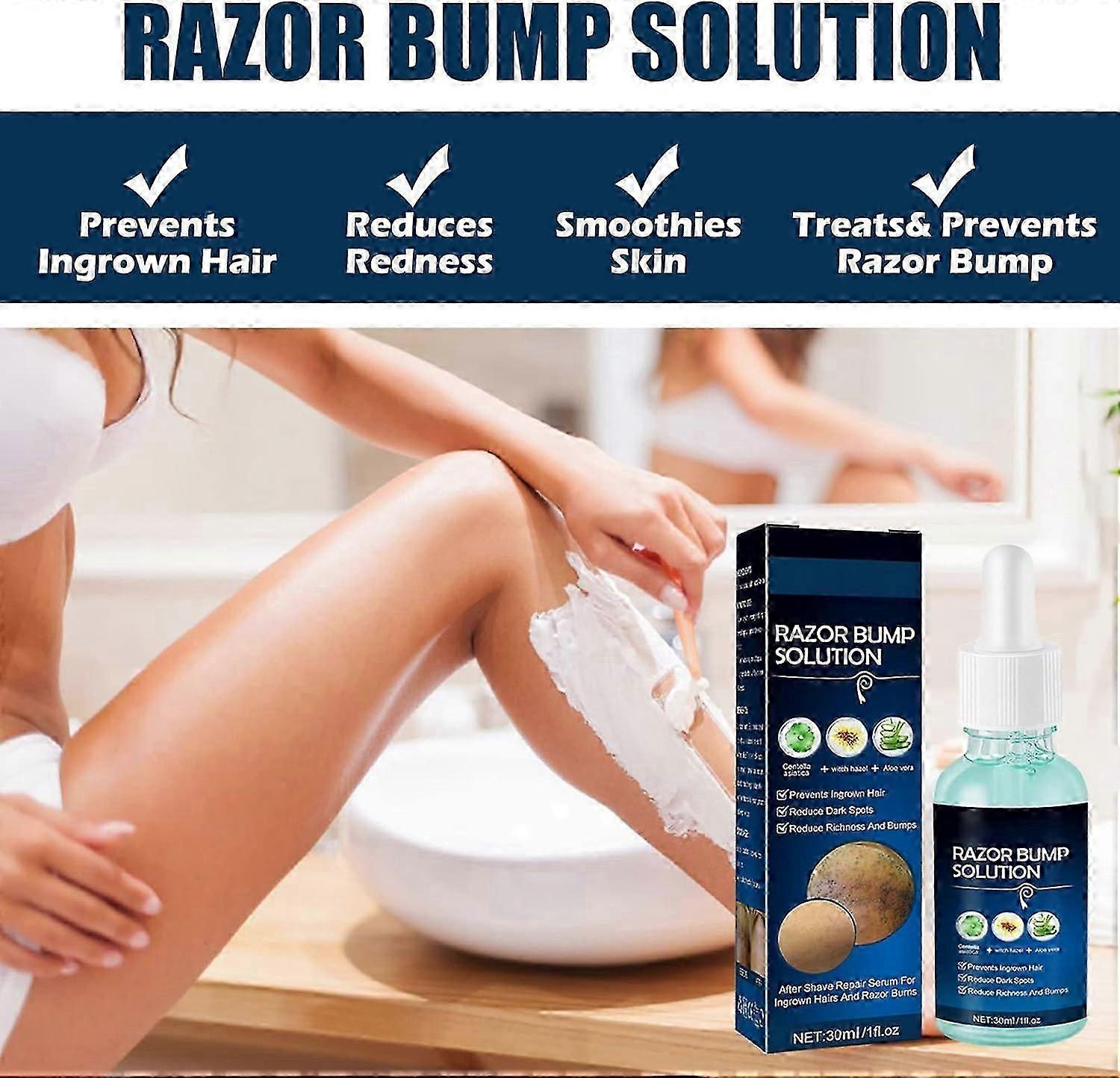 Razor Bumps Solution for Women and Men, Ingrown Hair Treatment, Razor Bump Treatment for Face ...