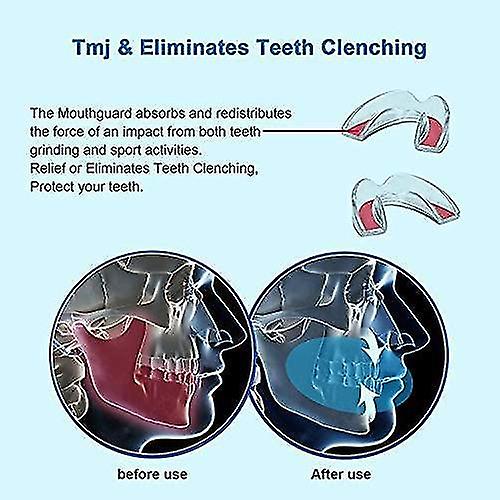 Kids Mouth Guard For Teeth Grinding, Pack Of 4 Bite Guards + Dental ...