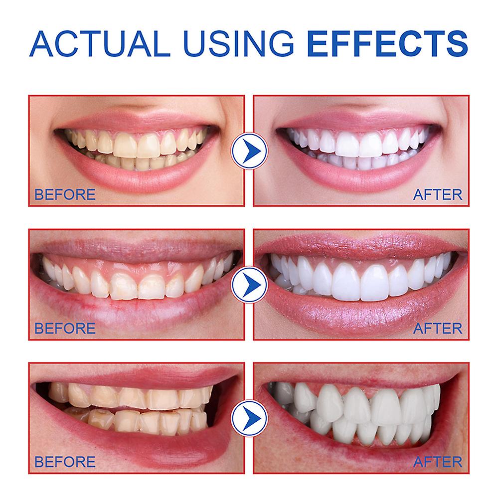 Whitening Toothpaste with Probiotics Easy Using Freshing Breath ...