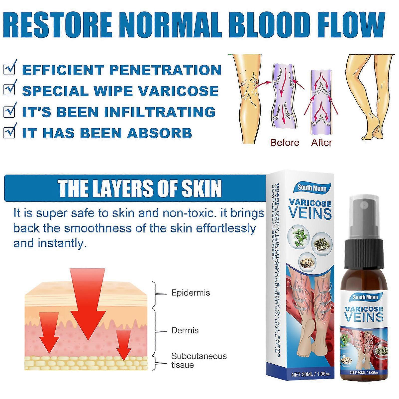 Varicose Vein Massage Spray 30ml Smoothing Vascular Bumps Smoothing ...