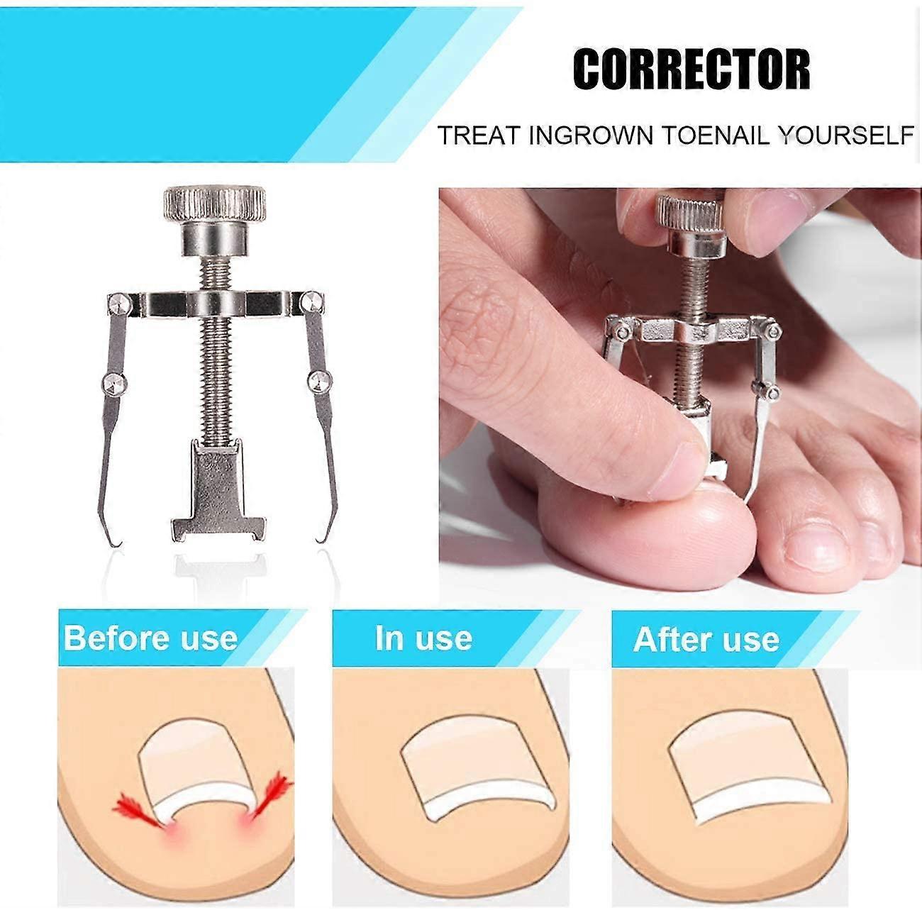 Ingrown toenail set 7 pieces, professional nail clipper set for strong ...