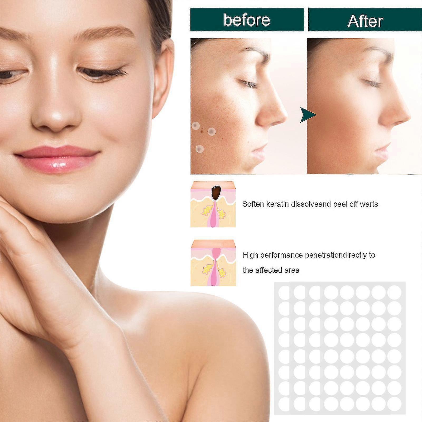 Skin Tag Remover Patches | Fruugo NZ
