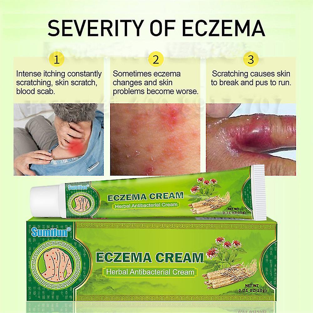 Psoriasis Cream Eczema Treatment Cream Psoriasis Hand Foot Odor ...