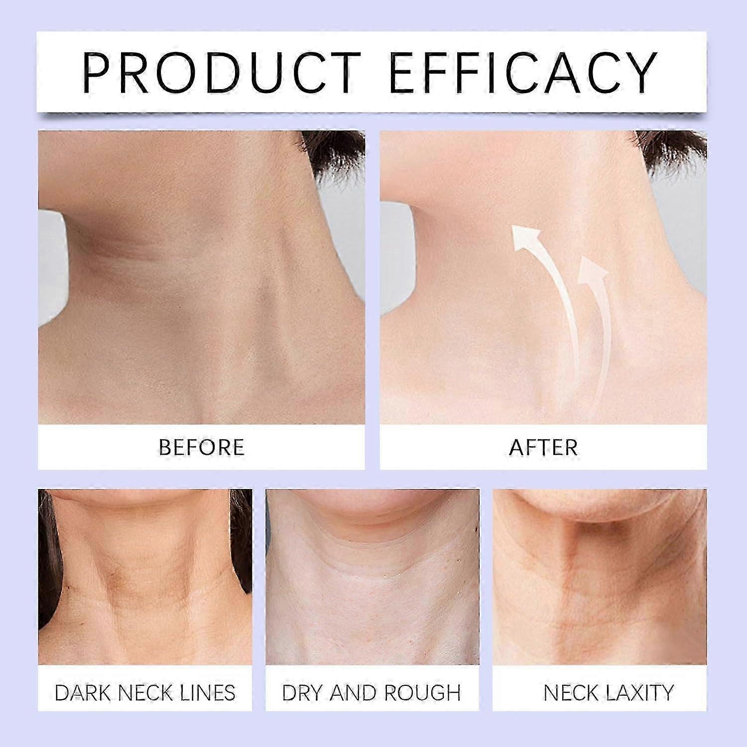 Neck Firming Cream, Neck Tightening Cream, Neck Lifting Cream, Anti ...