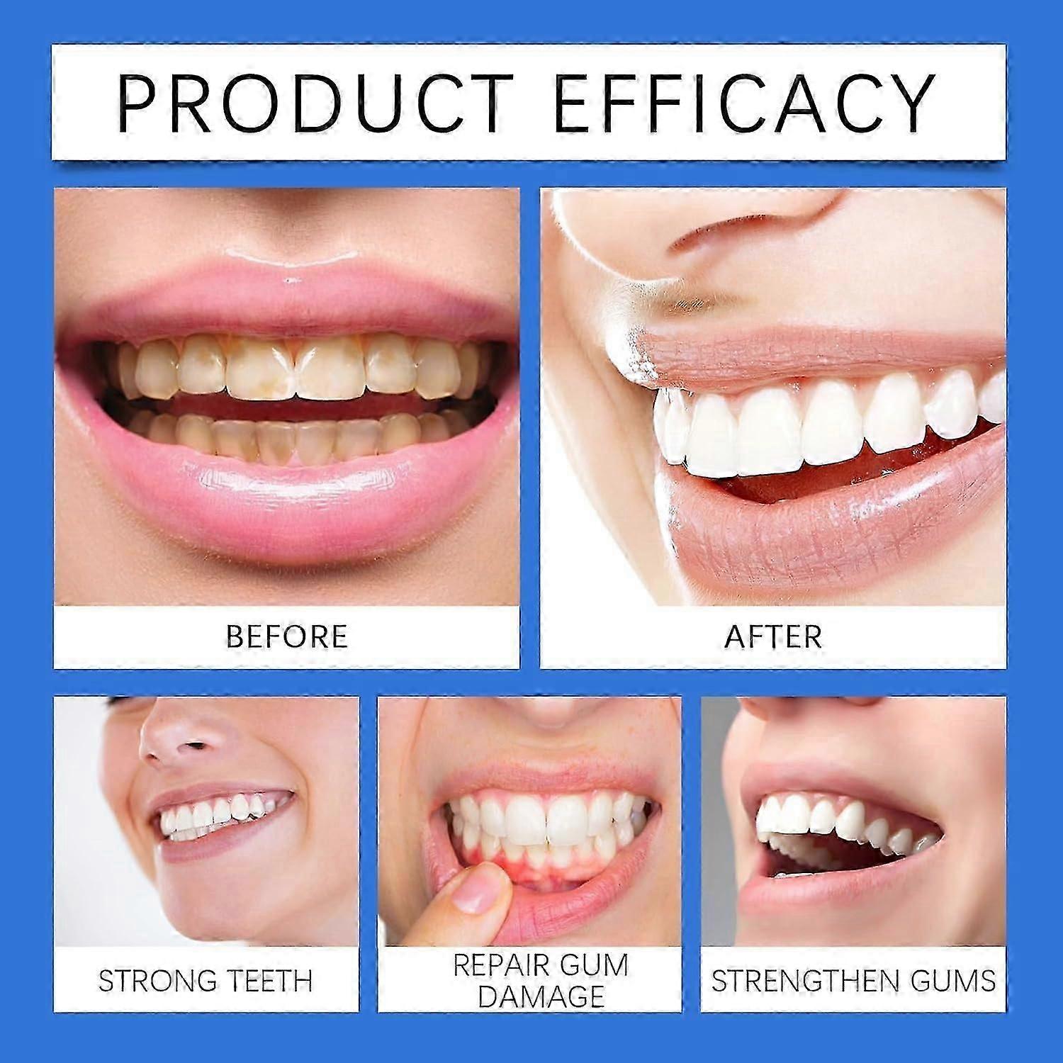 Gum Restore Liquid - Gum Therapy Serum, Gum Repair Drops for Receding ...