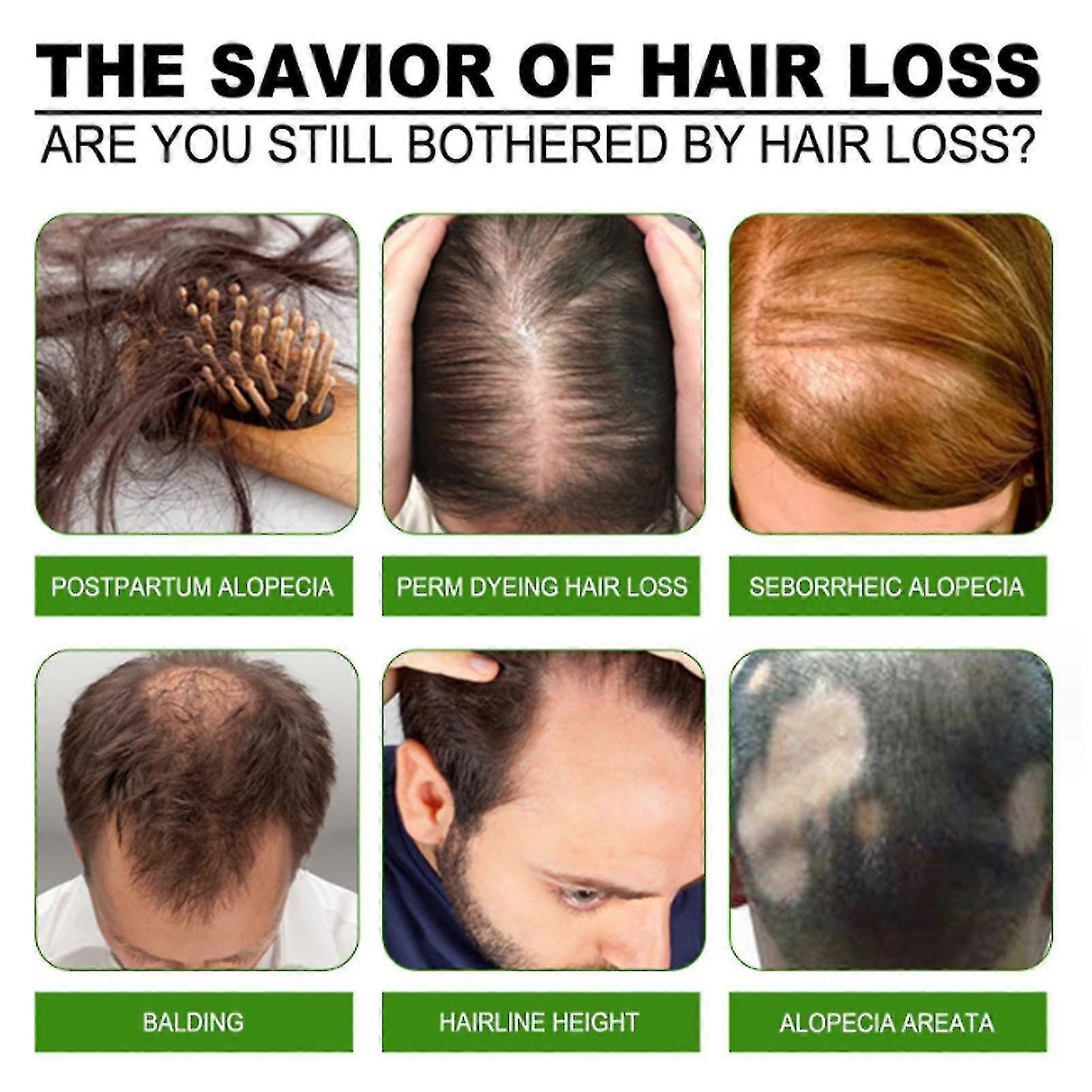 South Moon Ginger Thick Hair Roll-on Scalp Care Nourish Hair Root ...