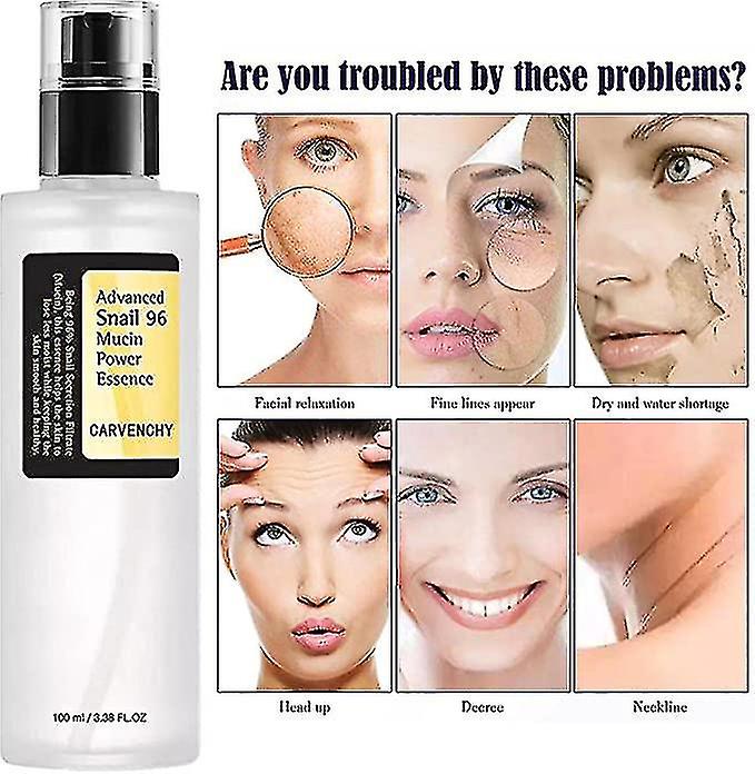 Snail Collagens Serums, Snail Mucin, 96.3 Snail Secretion Filtrate ...