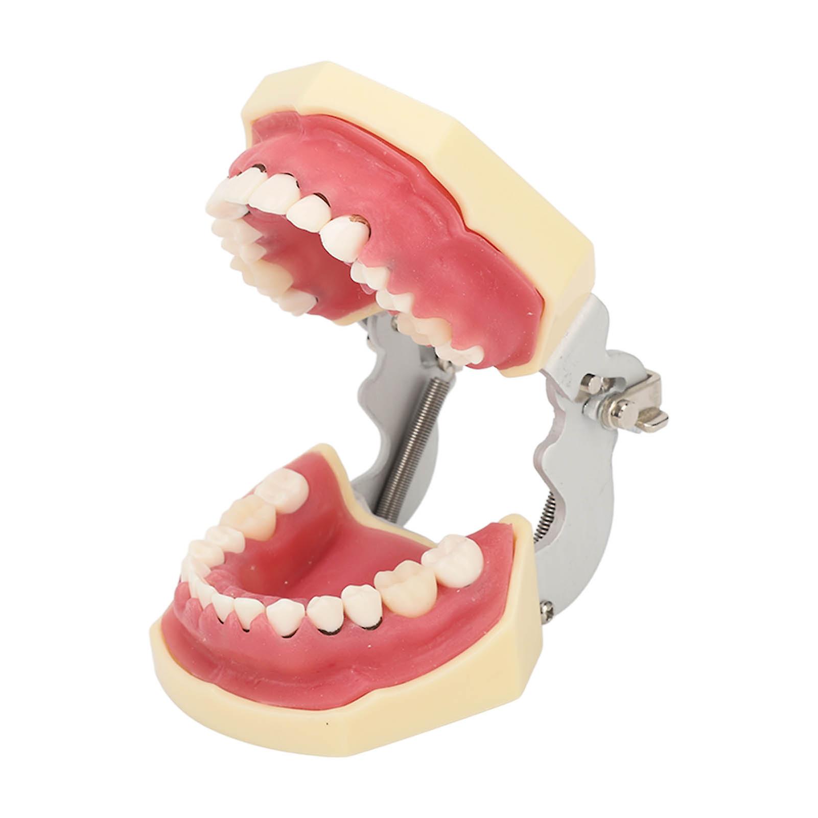 Periodontal Disease Teeth Resin Model Dental Demonstration Teeth Model ...