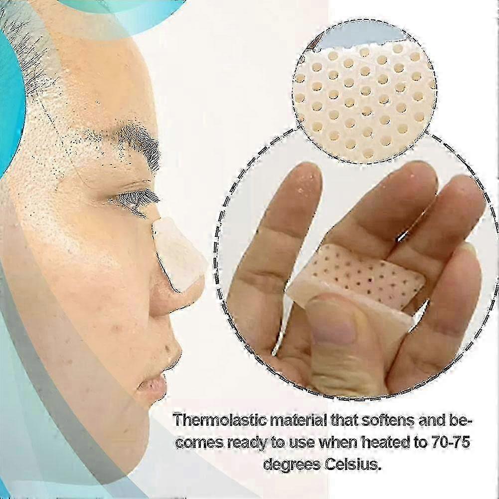 External Protective Devices for Nose Fracture Repair Made of ...