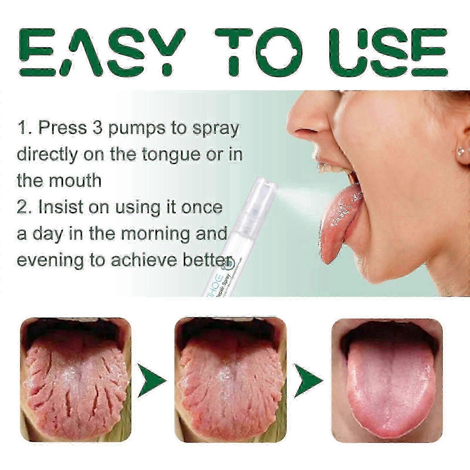 1pcs Tongue Repair Spray, Moisturizing Whitening Oral Care for Dry ...