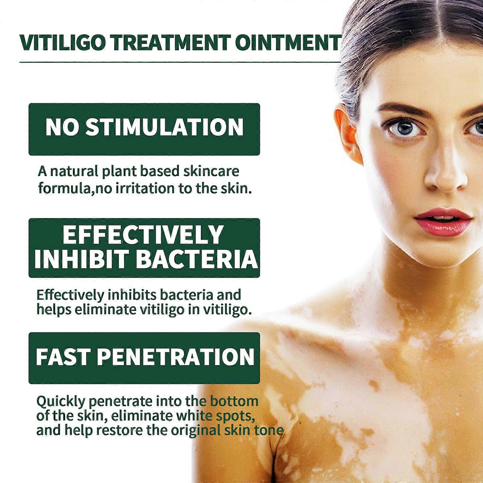 Vitiligo Treatment Ointment with Eliminate Pigmentation Comfrey Anti ...