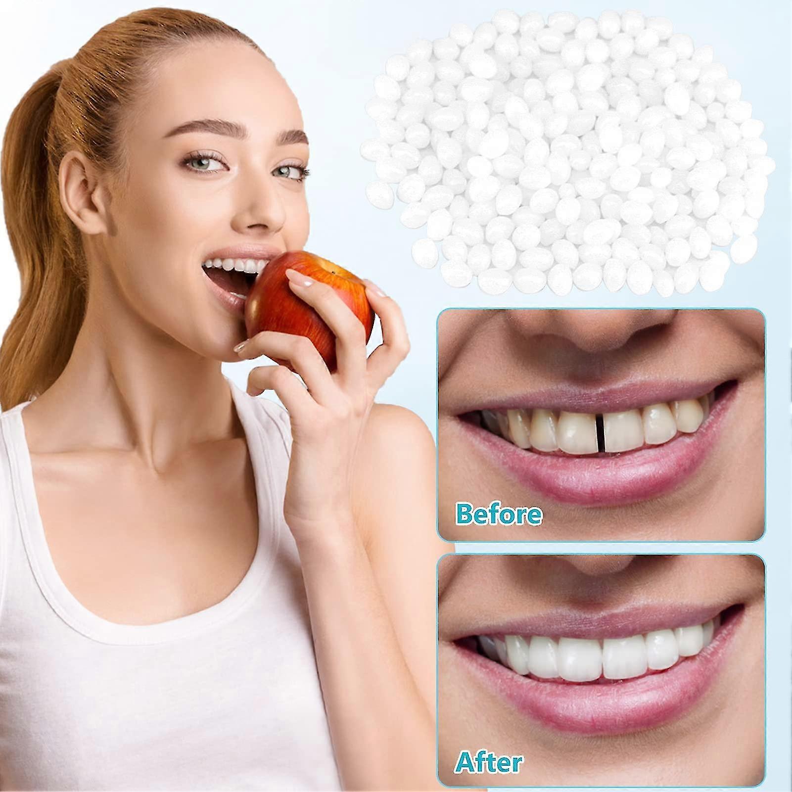2 Pairs False Teeth Veneers, Veneers Teeth Cosmetic Tooth Cover Fake ...