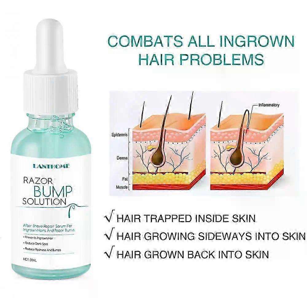 Razor Bump Plug After Shave Hair Growth Treatment Reduces Dark Spots ...