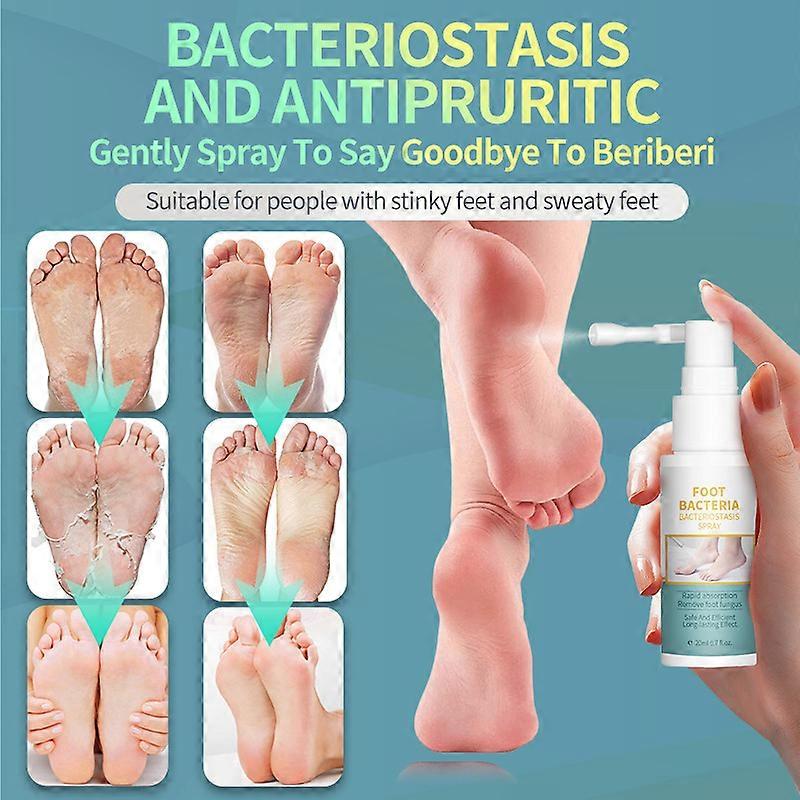 Athlete's foot spray, itchy feet, smelly feet, sweaty feet, foot care ...