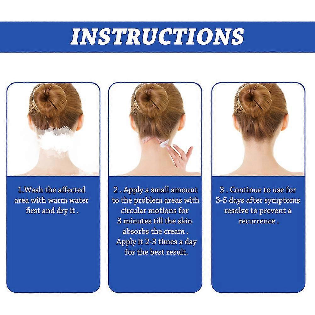 2stk Behandling af psoriasis Seborrheic Dermatitis Cream Head Acne ...