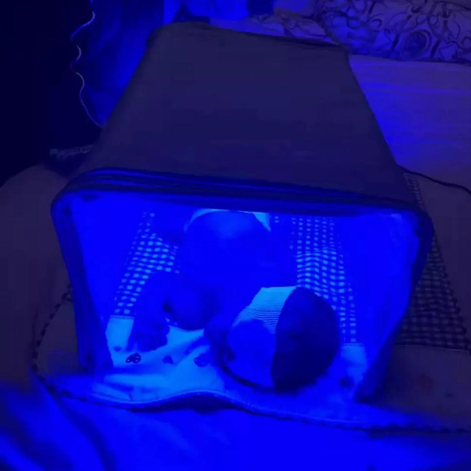 NewBorn Baby Neonatal Jaundice Relief Therapy Treatment Blue Light ...