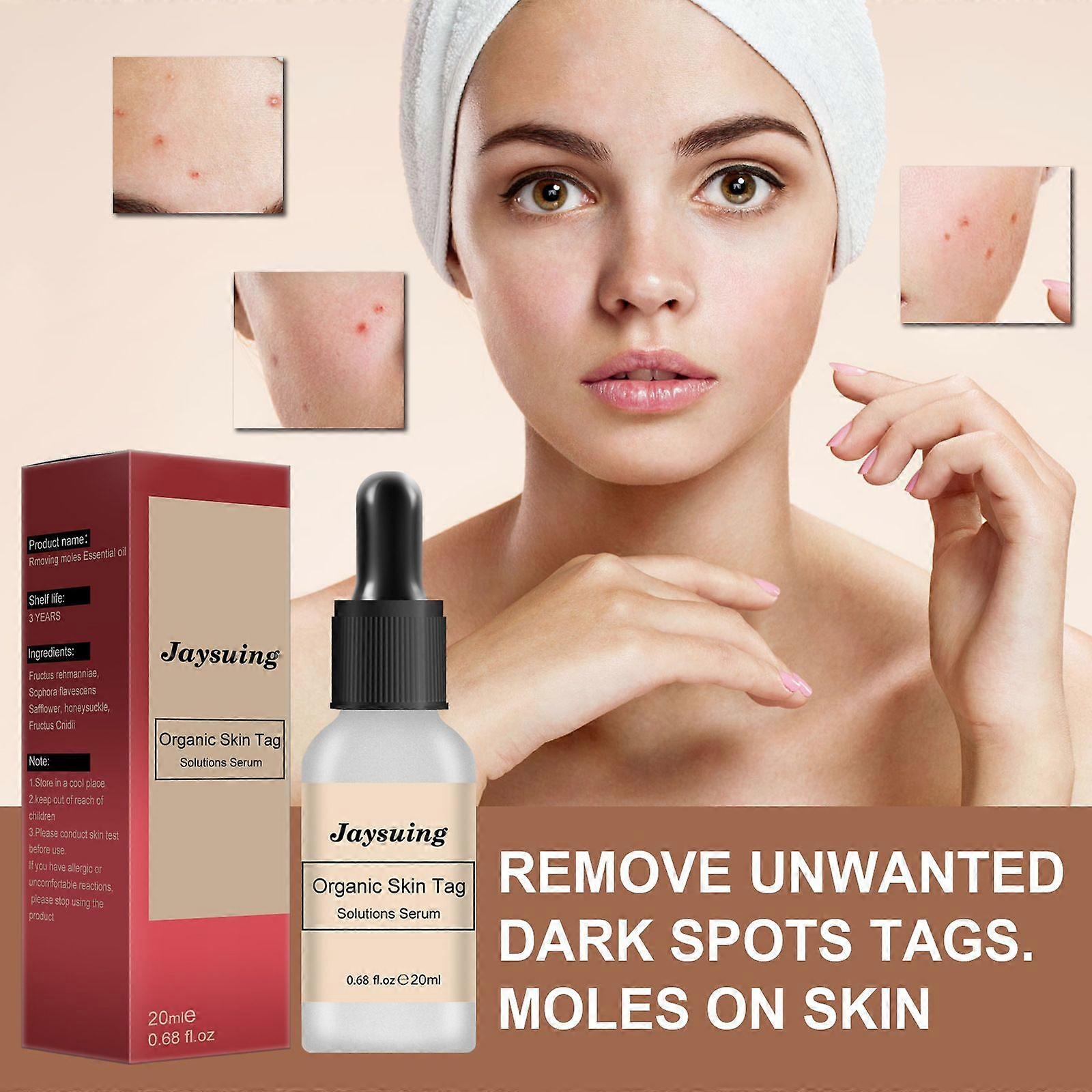 Eliminate Nevus Potion, Remove Nevus Repair And Remove Warts Cleaning ...