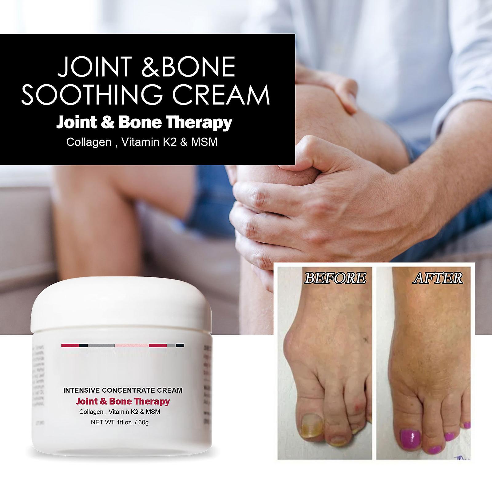 Joint & Bone Therapy Cream Perfectx Joint And Bone Therapy Cream With ...