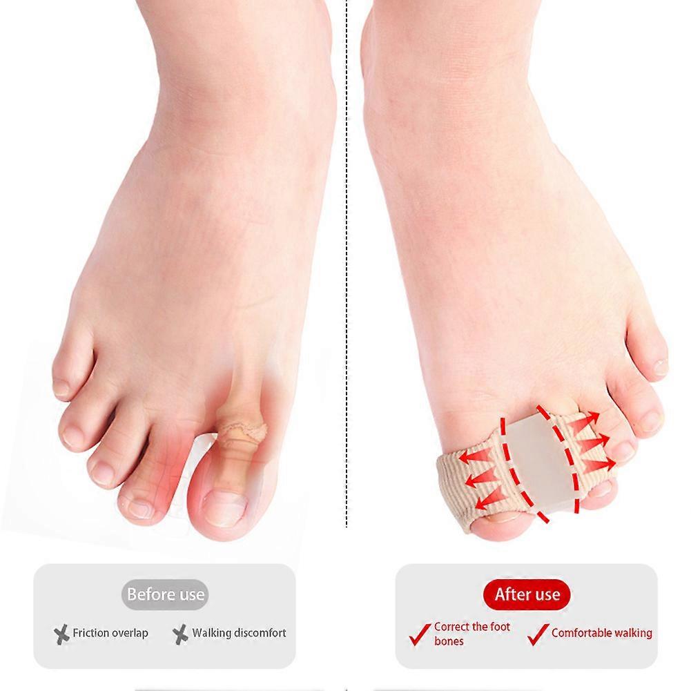 Toe Separators, Gel Toe Spacers with 2 Loops, Breathable Hammertoe ...