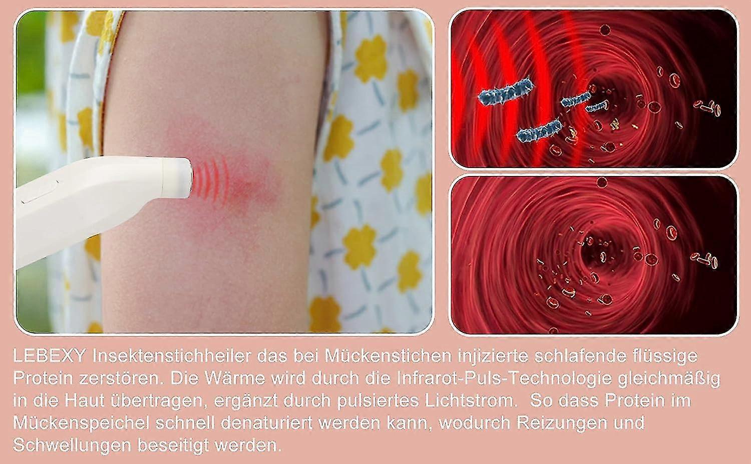 Electric Insect Bite Healer, Insect Bite Healer, Electric Bite Healer ...