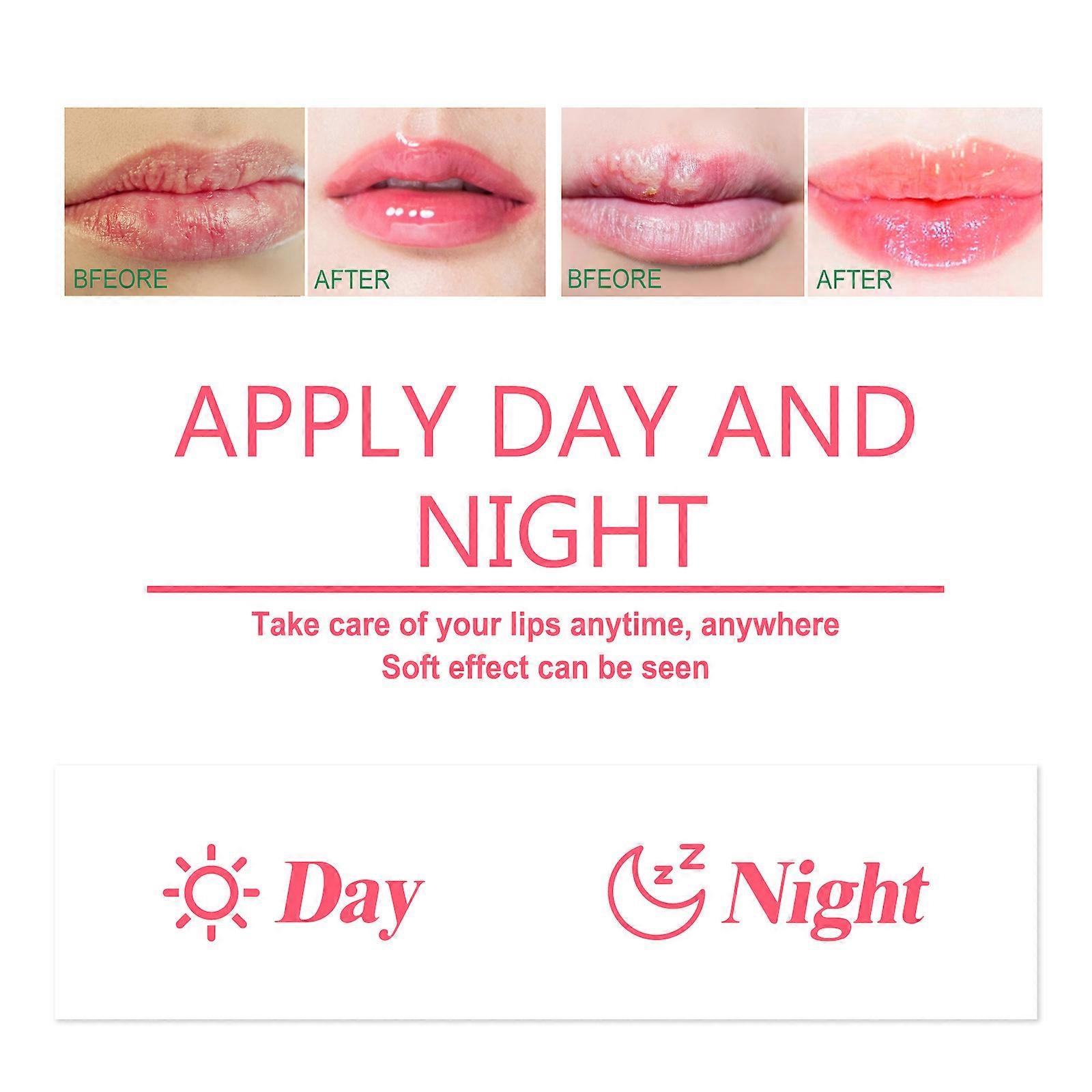 Cold Sores Therapy Oil For Lips Not Greasy Lip Repair Not Sticky Lip ...