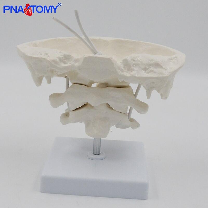 Enlarged Detachable Human Cervical Vertebra Atlas And Axis Bone Spine ...