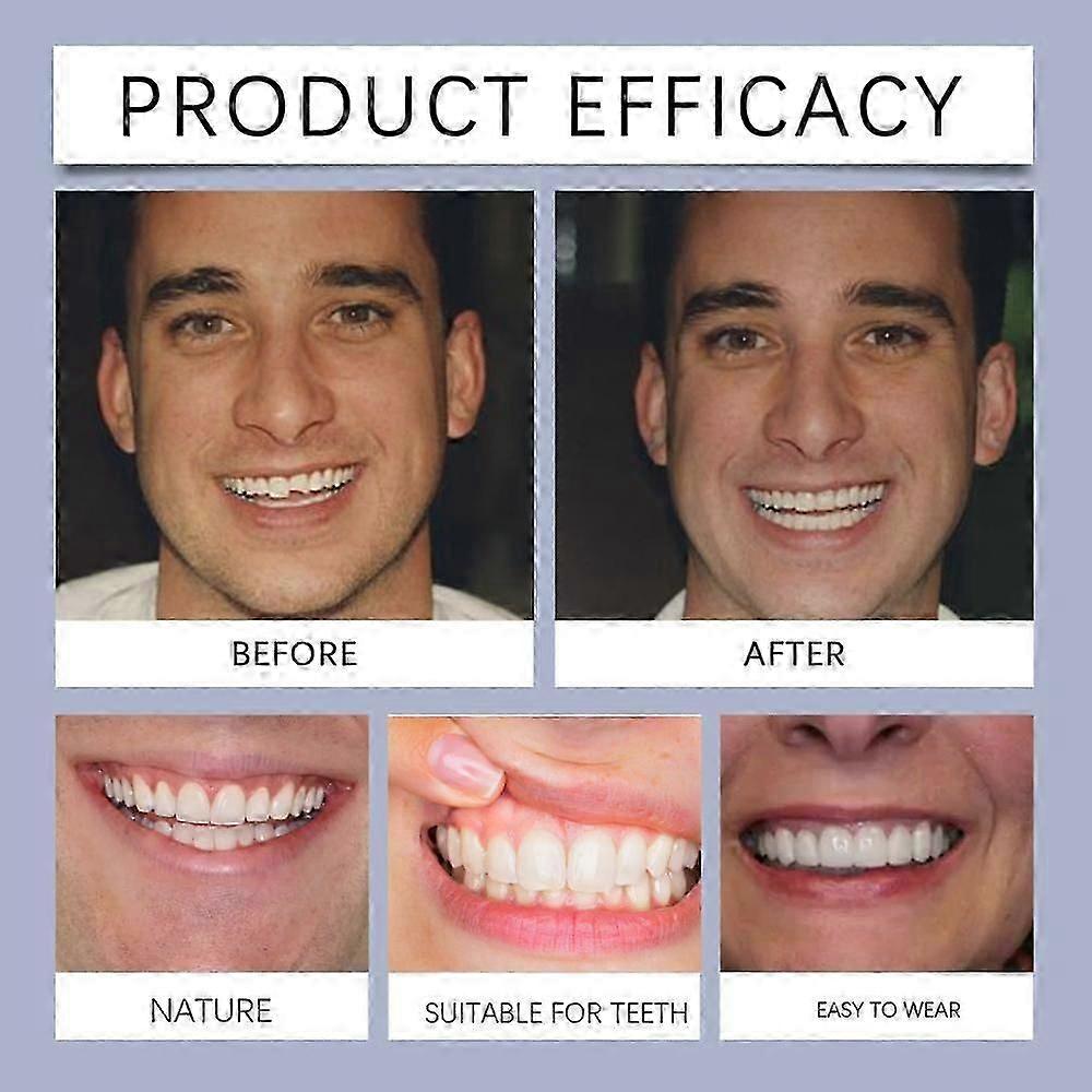 Soft Denture Reline Kit, Denture Repair Kit, Snap On Dentures Teeth ...