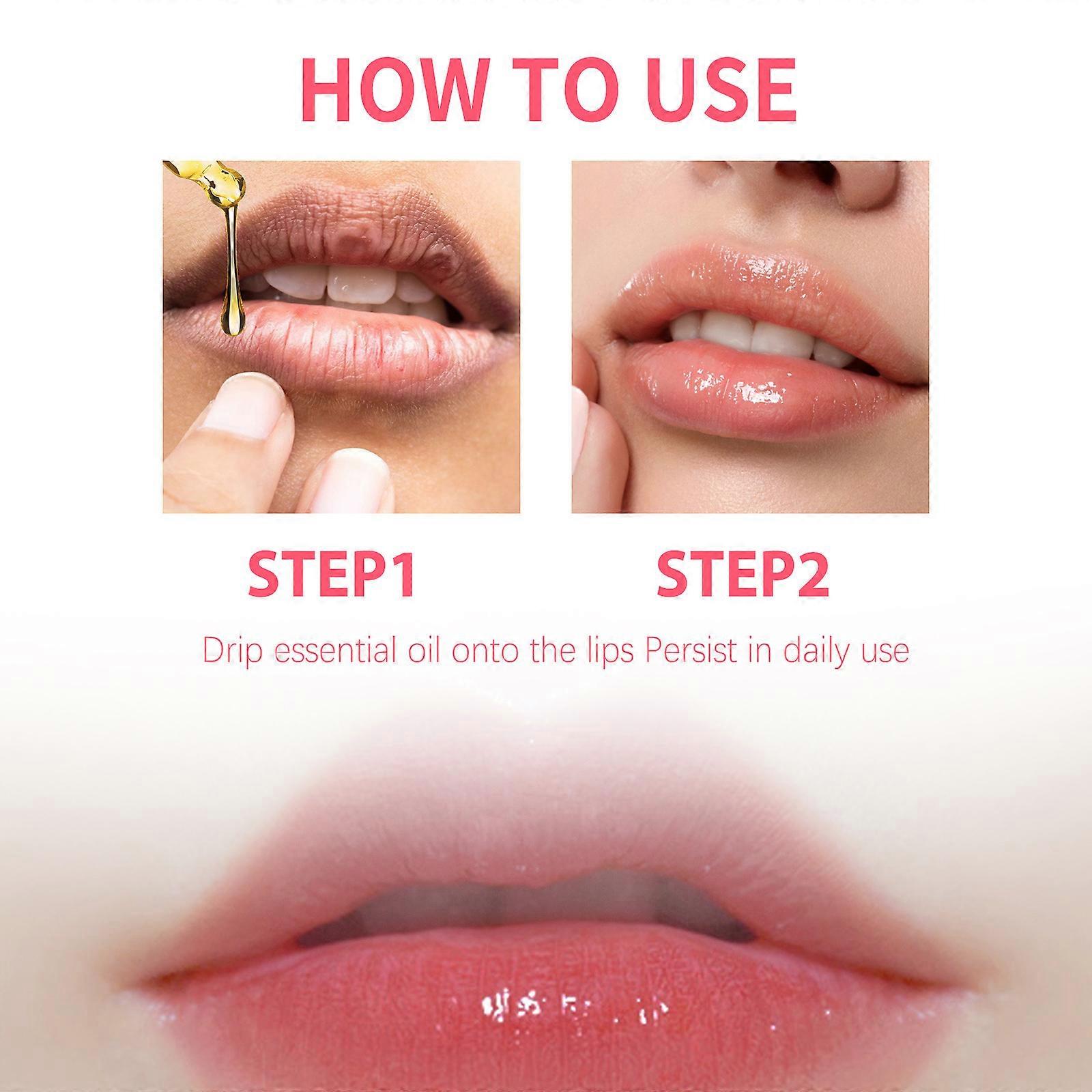 Cold Sores Therapy Oil For Lips Not Greasy Lip Repair Not Sticky Lip ...