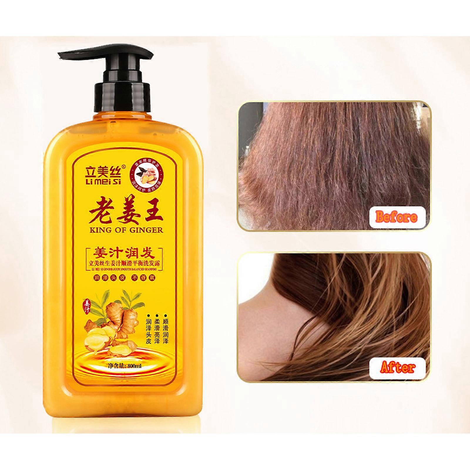 The Summer I Turned Pretty Ginger Hair Regrowth Shampoo Ginger Shampoo ...