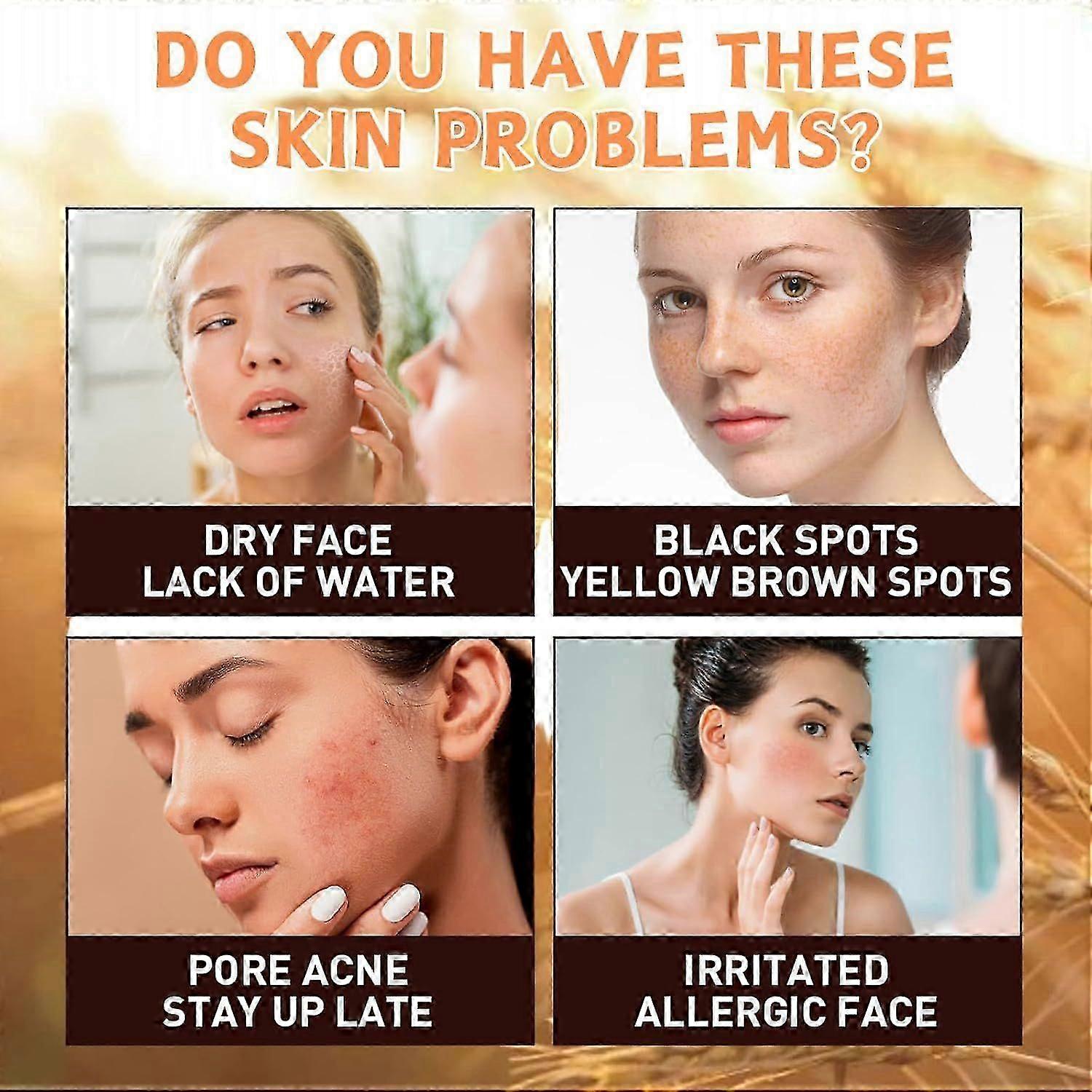 Rice Cream for Face, Rice Moisturizer with Niacinamide, Anti-Aging Face ...