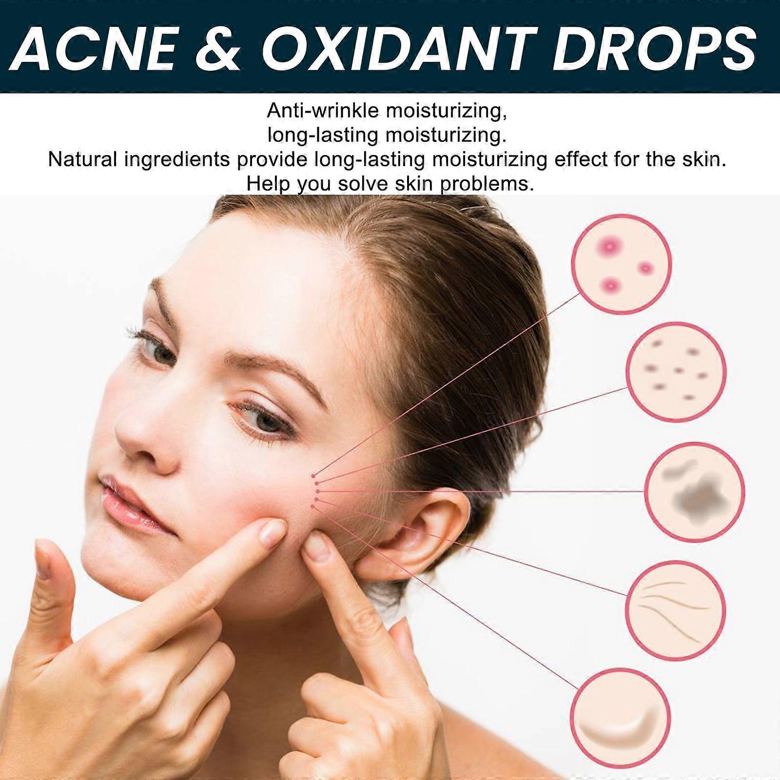 Acne Drops Deep Hydrating Moisturizing Moisturizing Fade Acne Pimples ...