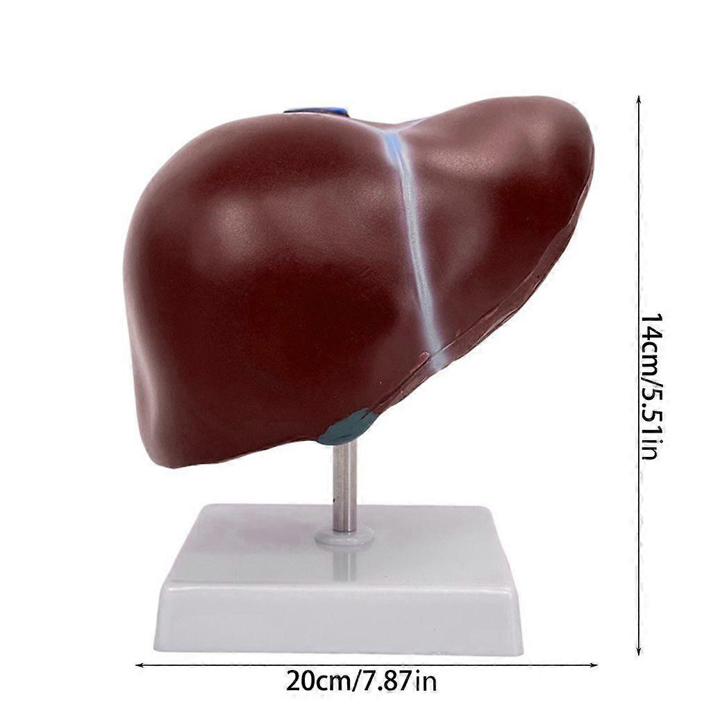Gallbladder Model Life Size Human Stomach Gallbladder Pancreas Duodenum ...