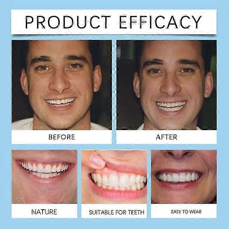 Soft Denture Reline Kit,False Teeth Set,Snap on Dentures,Soft Dentures ...